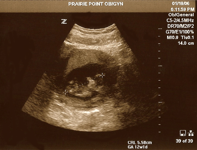 Baby Page